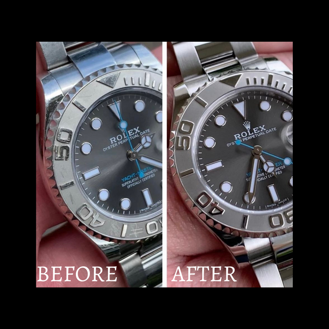 ROLEX REPAIRS | ROLEX BRACELET REPAIR | Elite Watch Co.